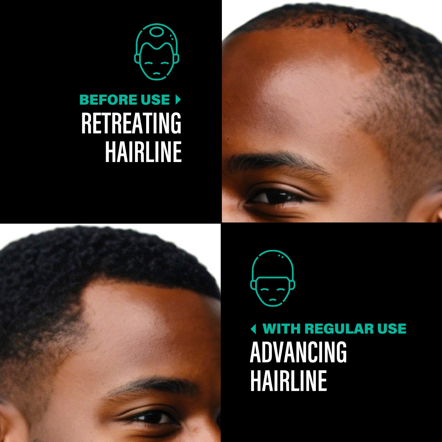 100% Unrefined Batana Oil 4oz - Hotana